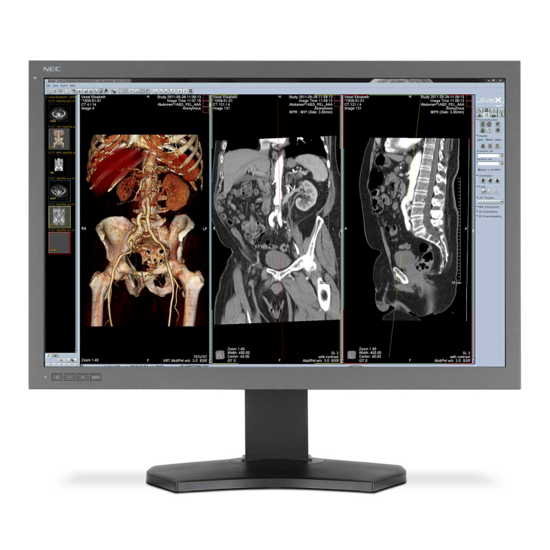Medische Monitoren: NEC MD302C6 - Met DICOM-kalibratie 6 MP 30" kleuren ...